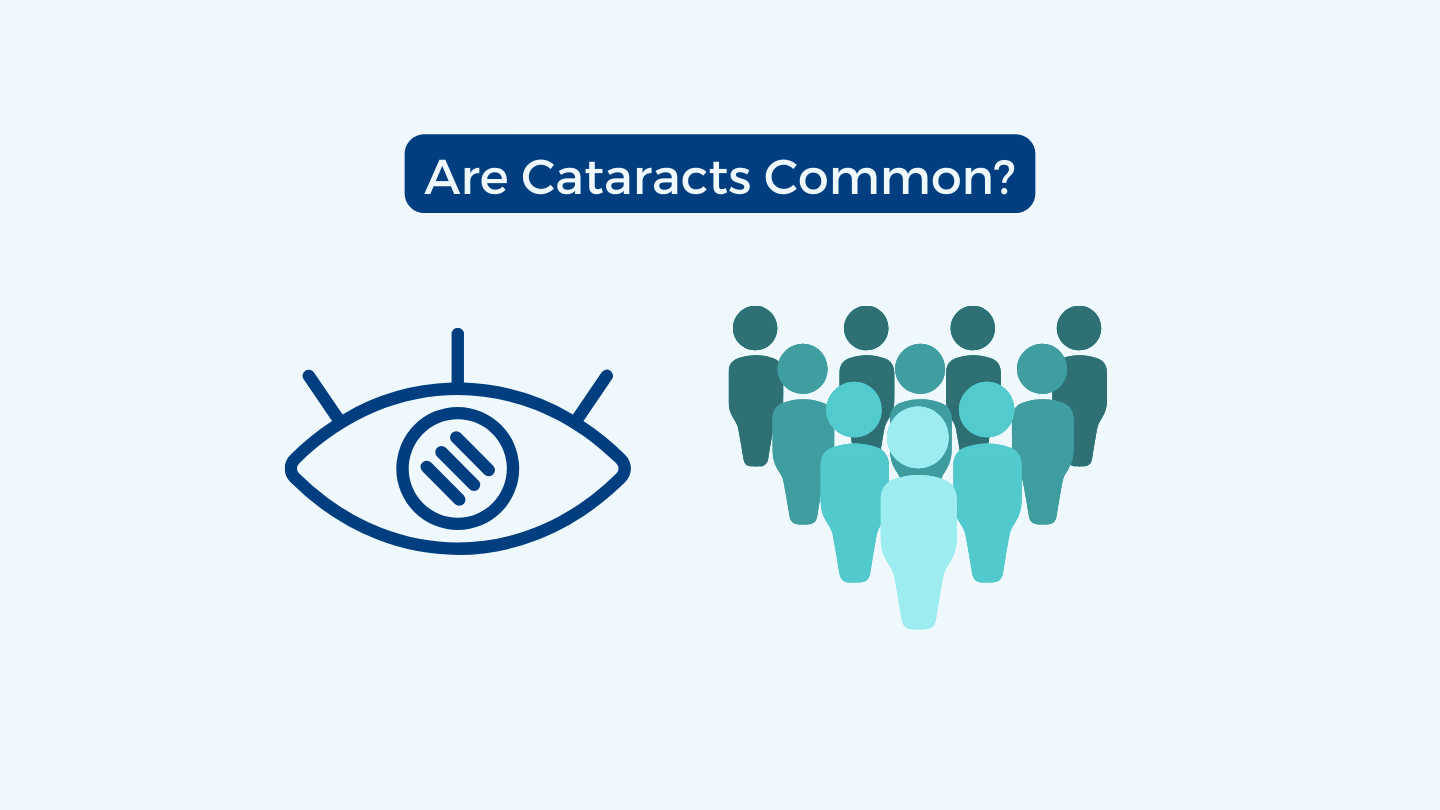 Are Cataracts Common? - Free State Eye and Laser