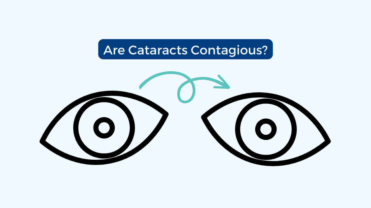 Are Cataracts Contagious? - Free State Eye and Laser