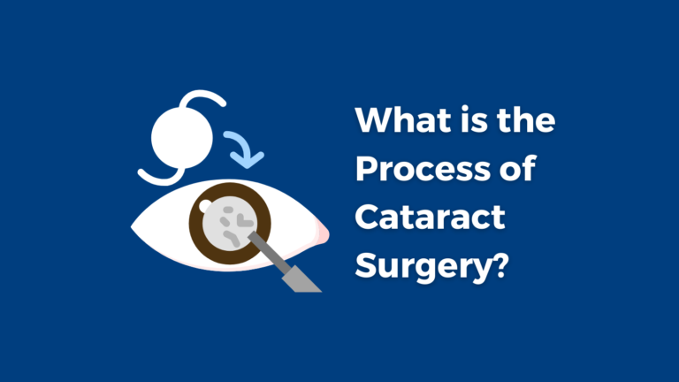 The Cataract Surgery Process Explained - Free State Eye and Laser