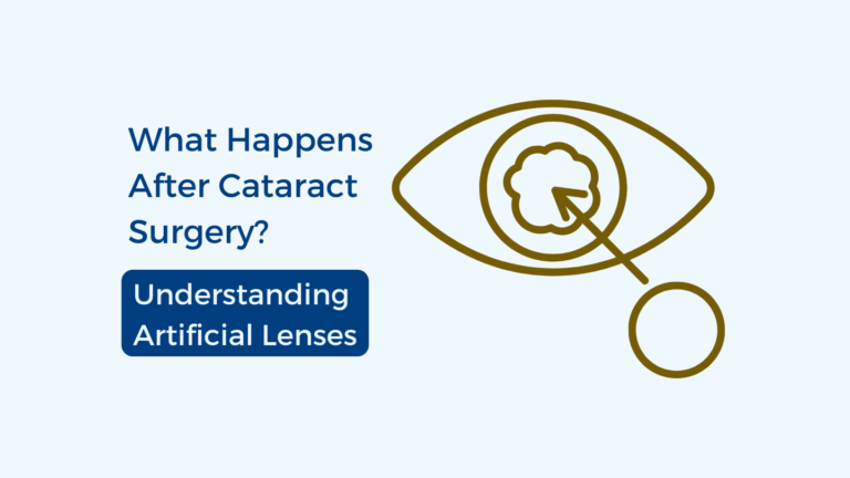 What Happens to My Eye After Cataract Surgery: Understanding Artificial ...